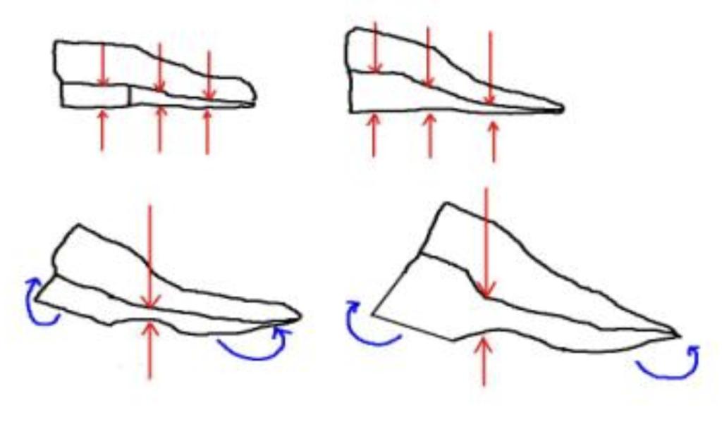 Plantar fasciitis pathway - Sheffield Aches and Pains - Professionals